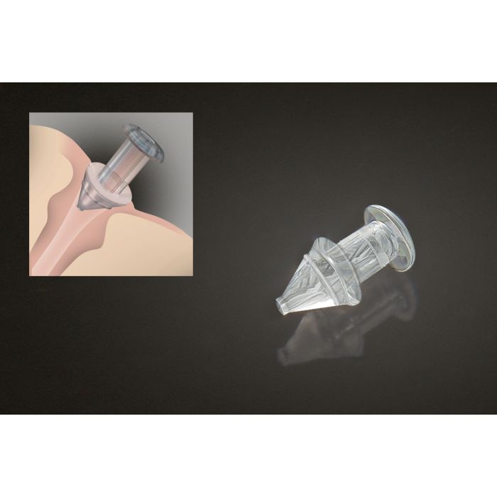 QPS05 Pedi Punctum Plug 0.5mm
